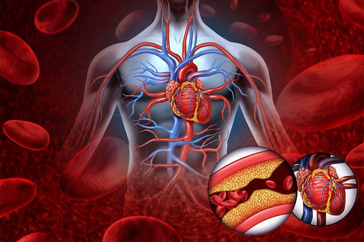 Treatment Of Hypertension Or High Blood Pressure MHospital